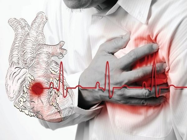 Heart Problems and Treatments | Marlin Medical Assistance